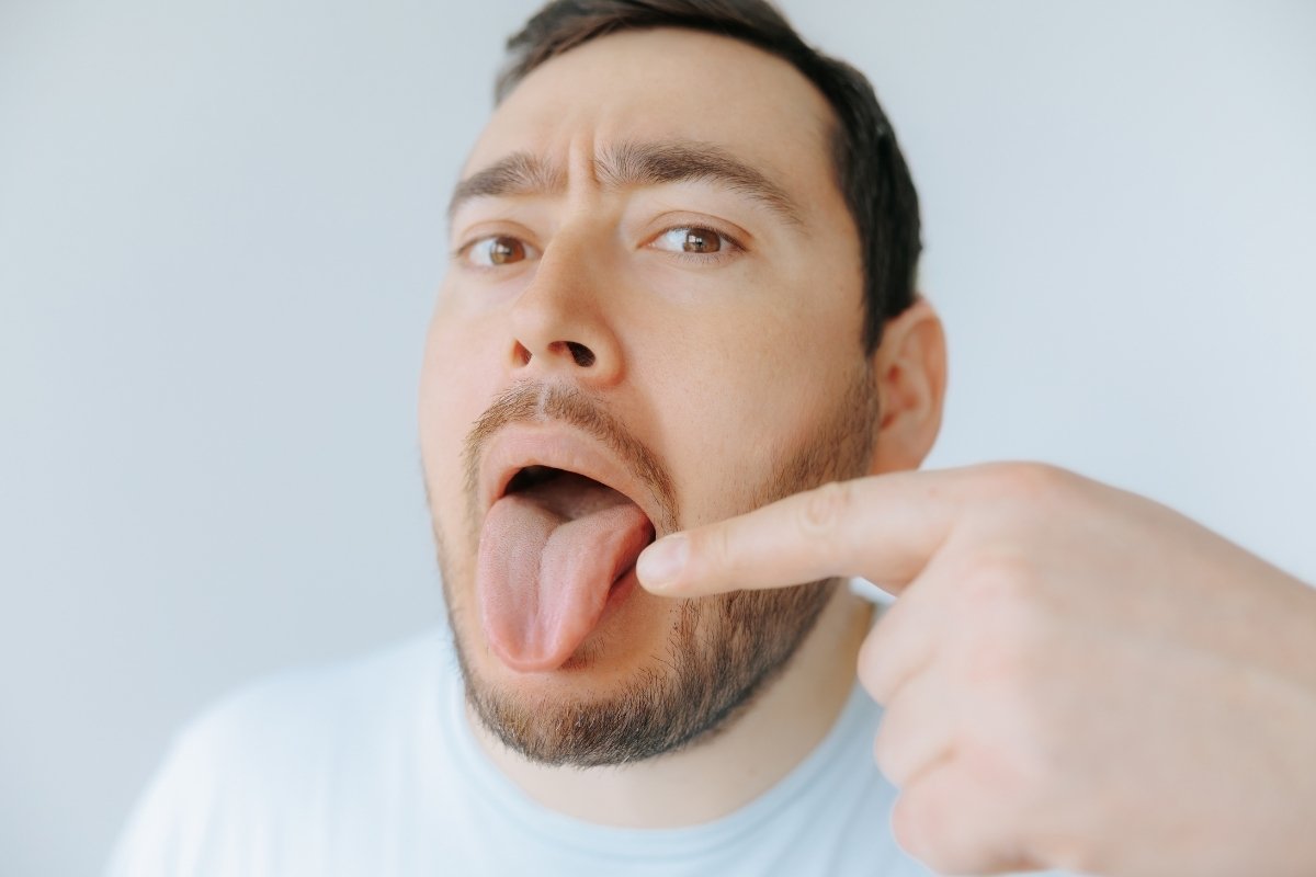 Burning Tongue Tip? Causes and What You Can Do